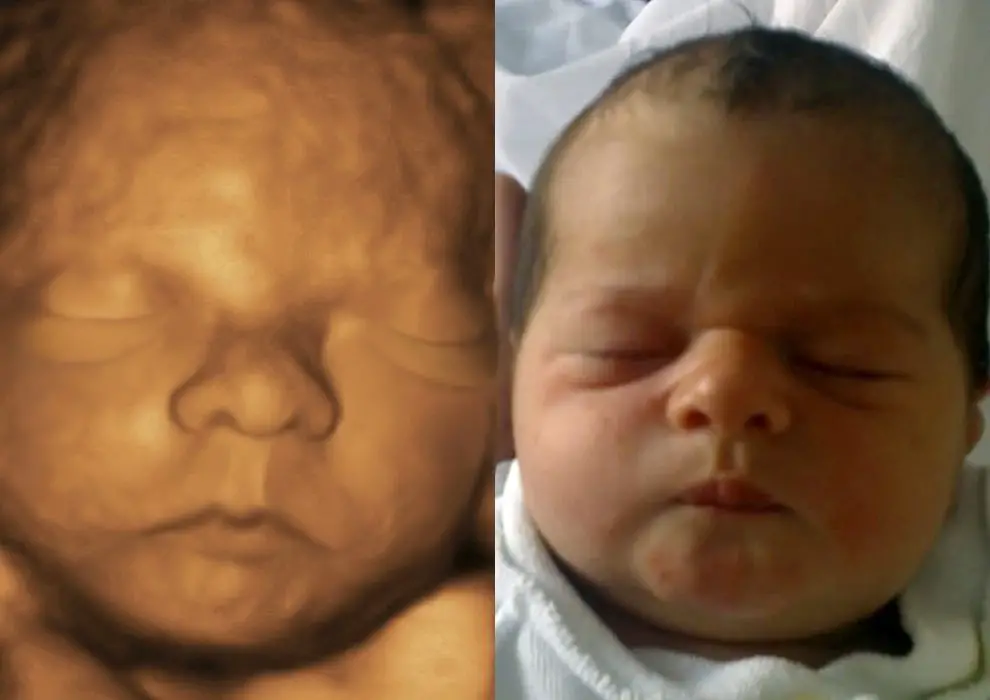 Ecografía 4D a domicilio ¡Vas a quererla para tu baby shower!