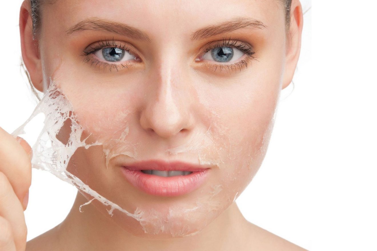 Piel escamosa: ¿Cómo cuidarla? ¡Causas, síntomas y tratamientos!