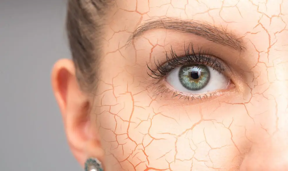 Piel deshidratada ¡Causas, consecuencias, tips y remedios para tratarla!