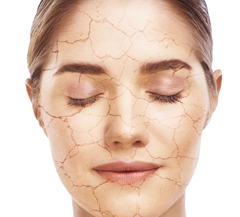 Cuidados para la piel seca que te evitarán arrugas