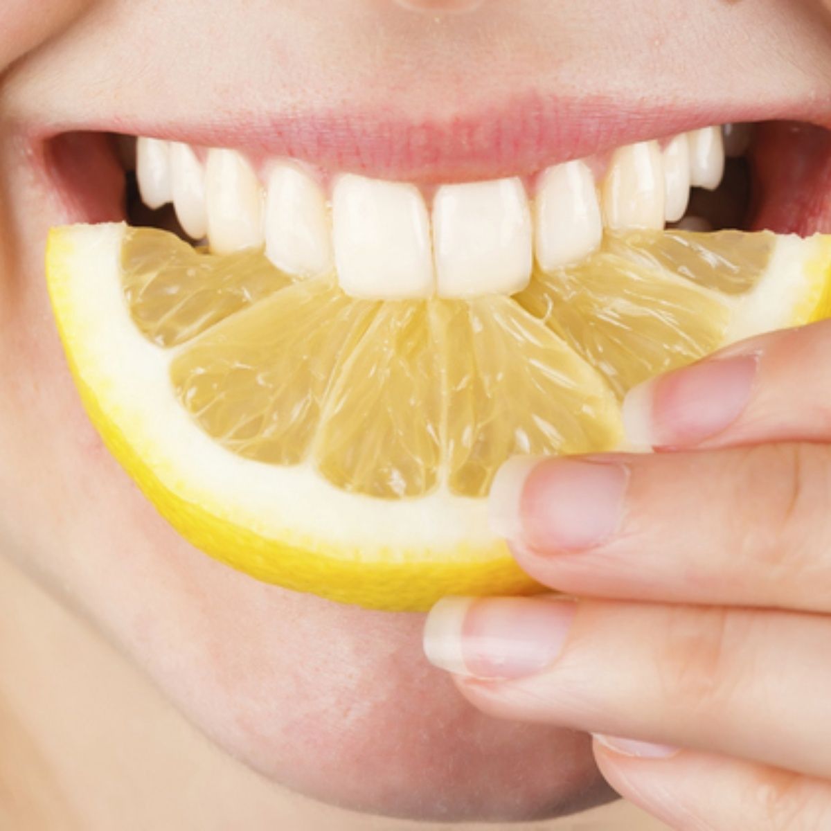 ¿Cómo quitar el sarro de los dientes? Consejos para eliminar la placa ...